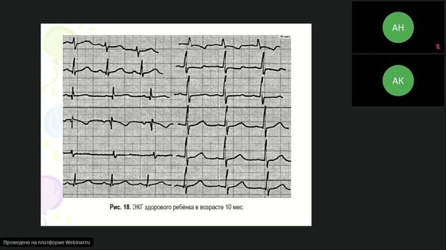 3-06-22 Куприянова АВ Детская ЭКГ.mp4