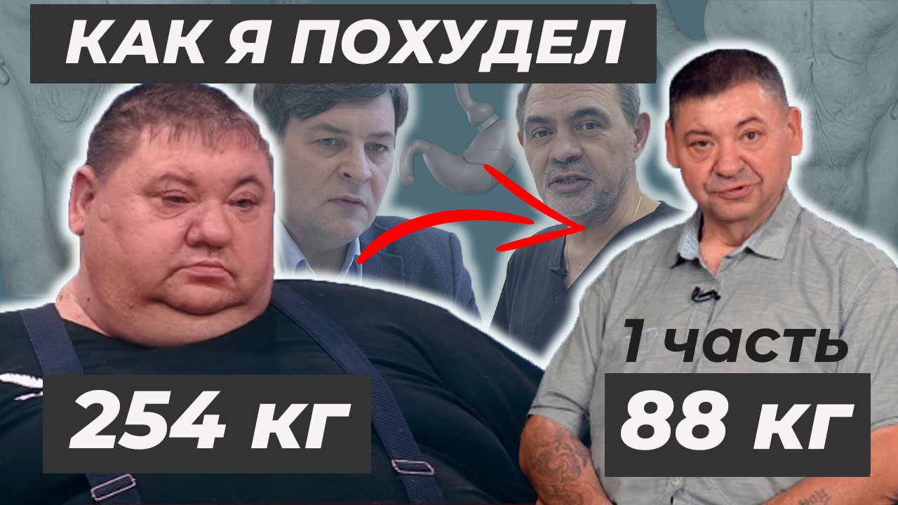 Кардинальное преображение. 1 серия.