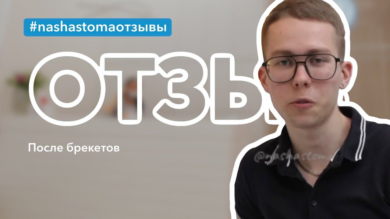 Трансформация улыбки после брекетов за 16 месяцев. Отзыв.