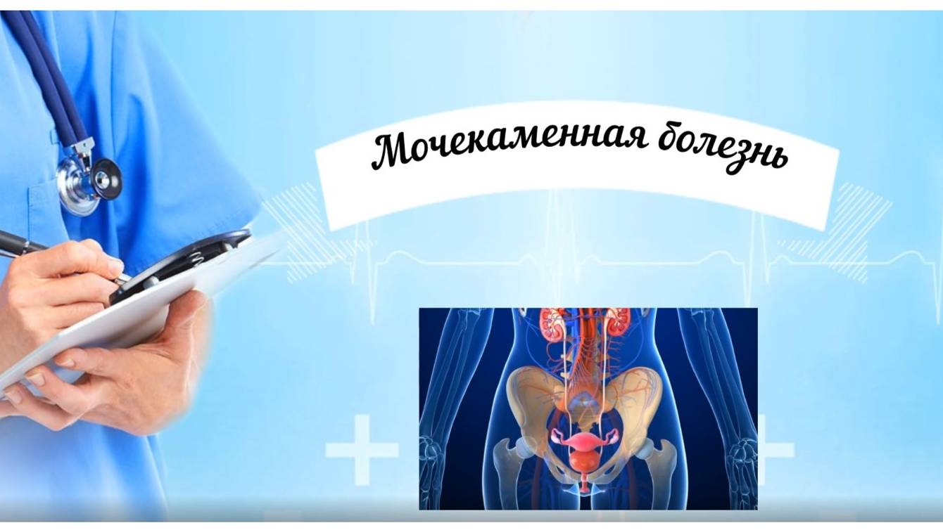 Мочекаменная болезнь (МПС часть 6)