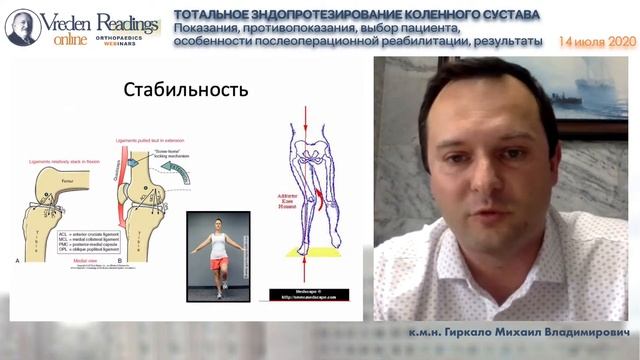 Вебинар 14 июля 2020 г. 16-00 (MSK) ''Как выбрать тип эндопротеза коленного сустава ''.mp4