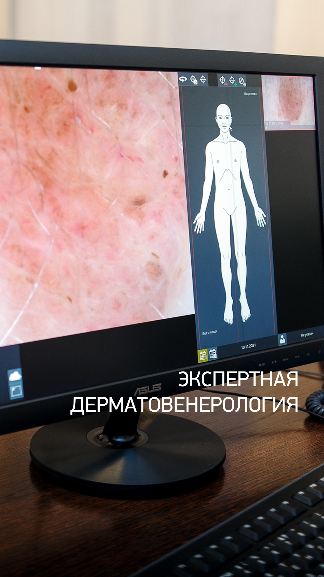 Экспертная дерматовенерология