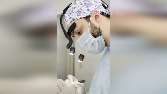 Круговая блефаропластика до и после операции