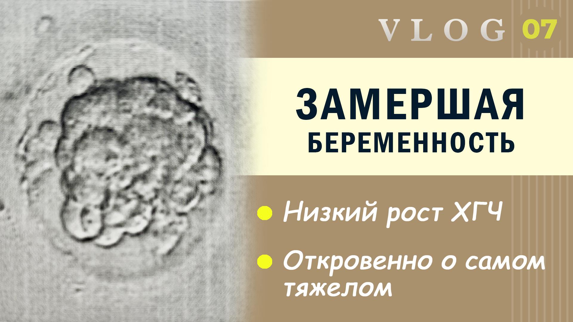 ЭКО. 8 недель замершей беременности ЭКО // Низкий рост ХГЧ