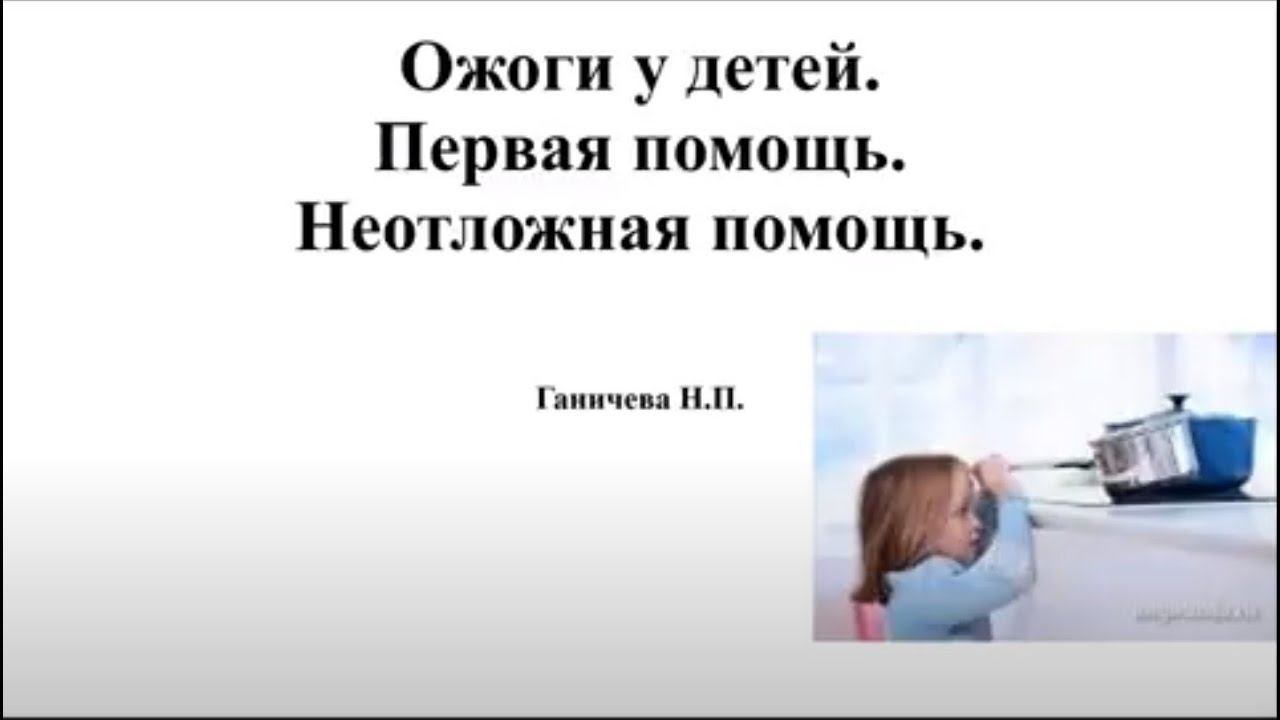 Ожоги у детей. Первая помощь. Неотложная помощь.  доцент Ганичева Н.П.