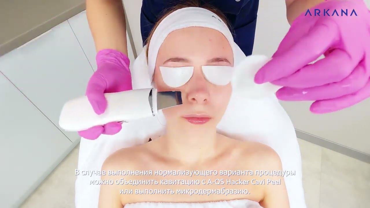 ACNE OUT THERAPY   ЧИСТКА ЛИЦА