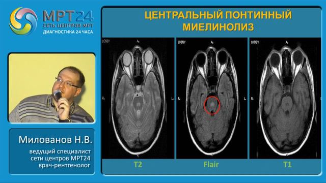Дифференциальная диагностика очаговых и объемных изменений головного мозга по МРТ