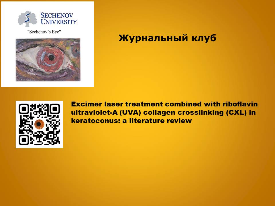 Лечение кератоконуса