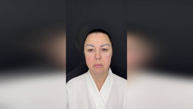 Осмотр перед фейслифтингом