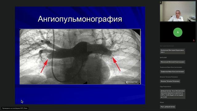 Тромбоэмболия легочной артерии этиология клиника диагностика лечение современные принципы профилакти