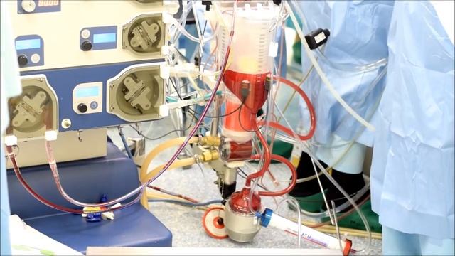 Кардиореанимация