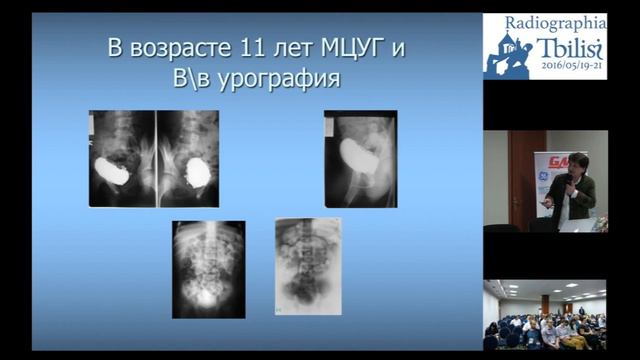 Инфравезикальные обструкции у детей