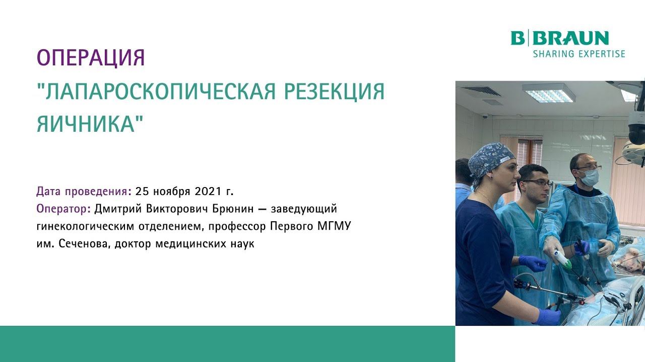 Лапароскопическая резекция яичника | Д.В. Брюнин
