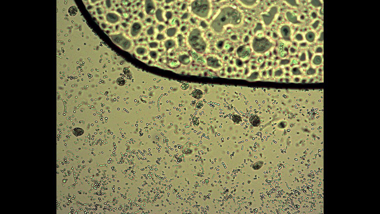 Инфузория туфелька, коловратка, бактерии под микроскопом Микромед 1