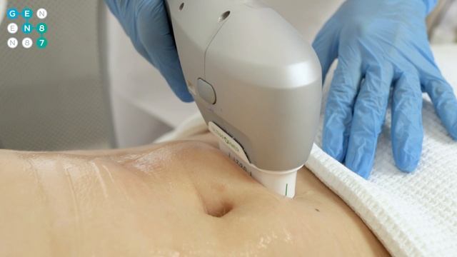 SMAS-лифтинг тела Ultraformer | Сеть клиник косметологии GEN87