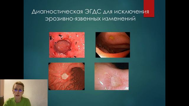 Потехина Е. В., к.м.н. Конференция по гастрономии 24 ноября 2022 г.