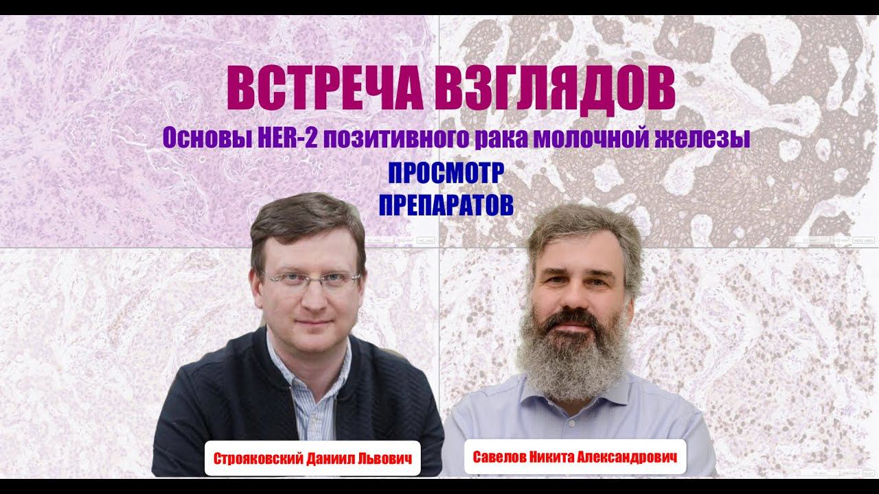 ВСТРЕЧА ВЗГЛЯДОВ || Препараты HER-2 позитивного рака молочной железы | ЧАСТЬ 1