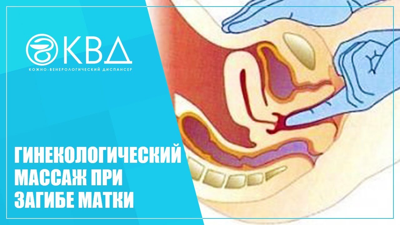 ✅ 1474  Гинекологический массаж при загибе матки