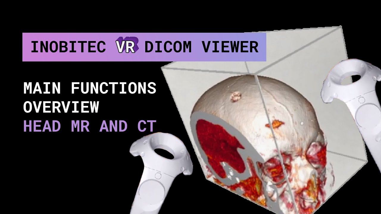 Обзор функциональности программы Inobitec VR DICOM Viewer. МРТ и КТ головы.