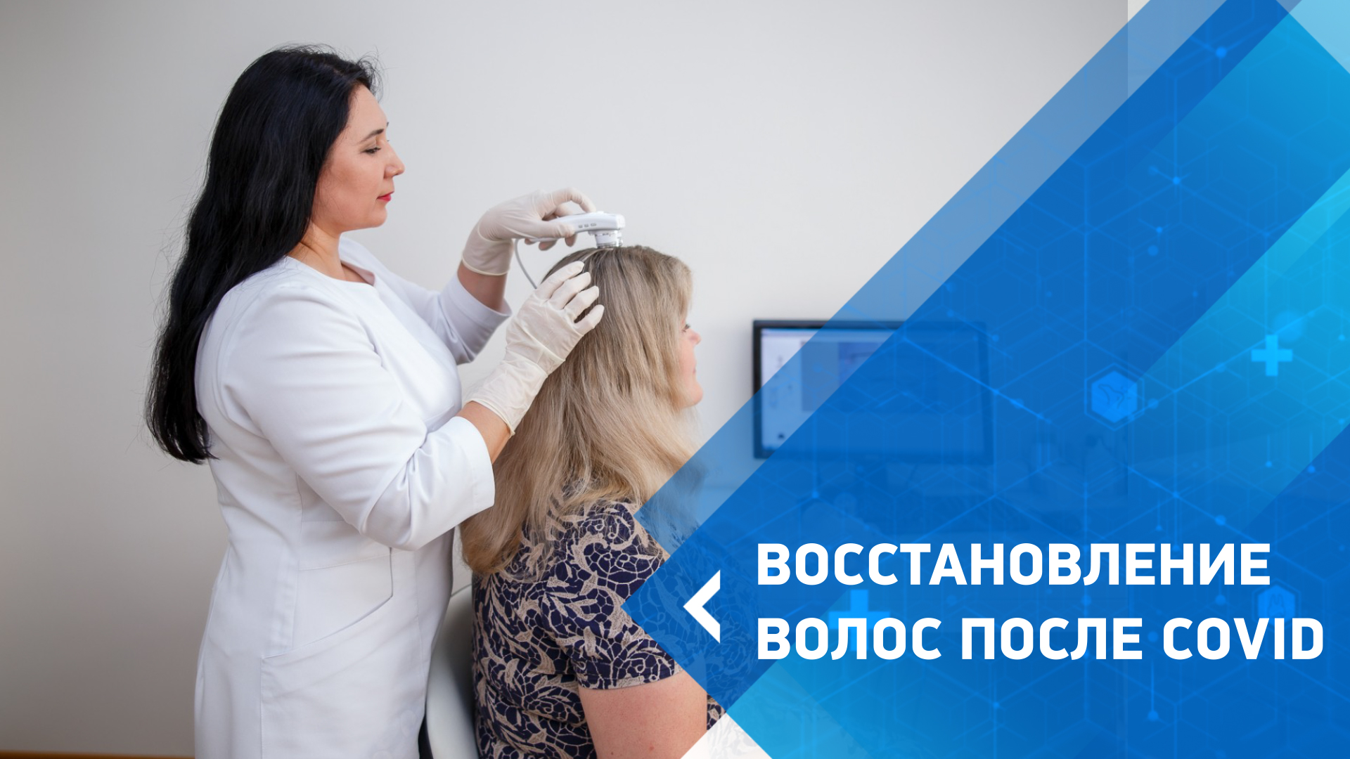 Восстановление волос после COVID