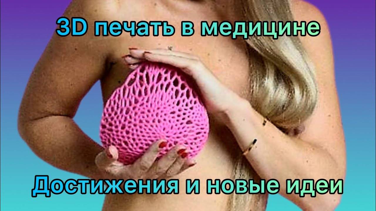 3д печать в медицине | Tpu filament | Что такое ТИТИФЛЕКС ???