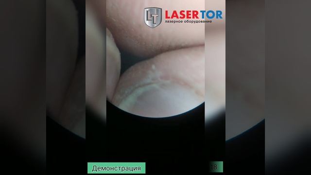 Лазерная пайка