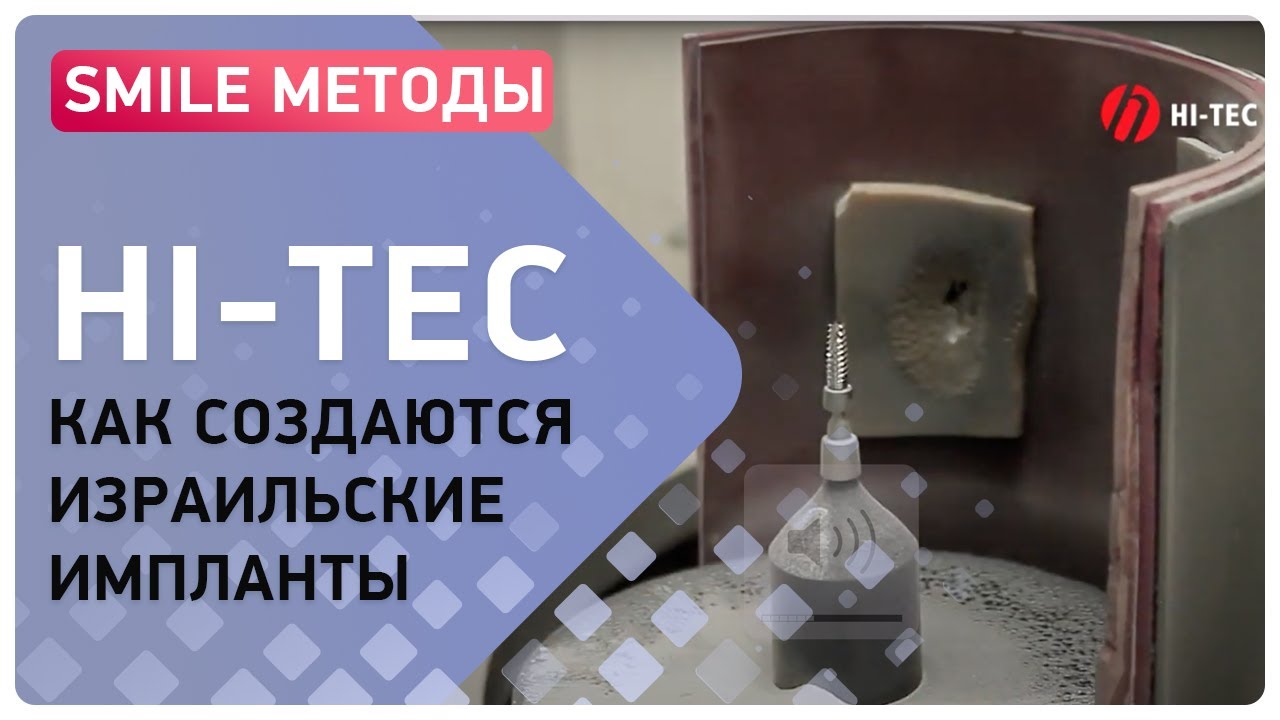 Импланты Hi-tec – как проводится изготовление