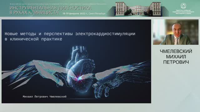 Новые методы и перспективы электрокардистимуляции в клинической практике