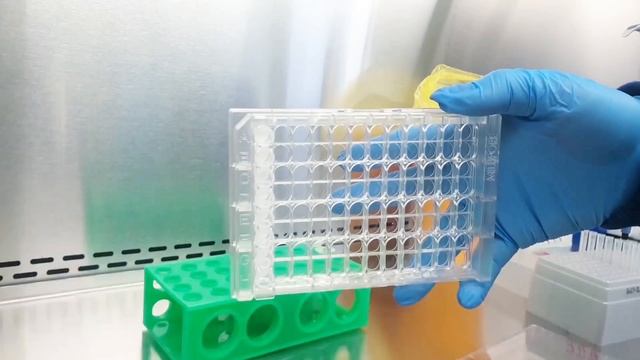 Исследование Т-клеточного ответа на вирус SARS-CoV-2 методом ELISPOT