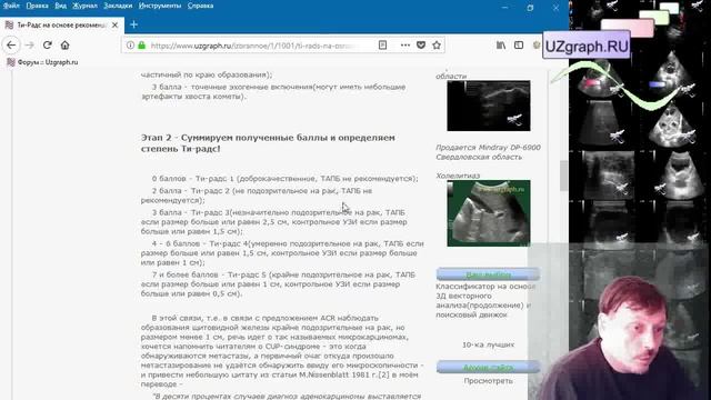 Аудио-статья: Ти-Радс на основе рекомендаций Американского Колледжа Радиологии (ACR)