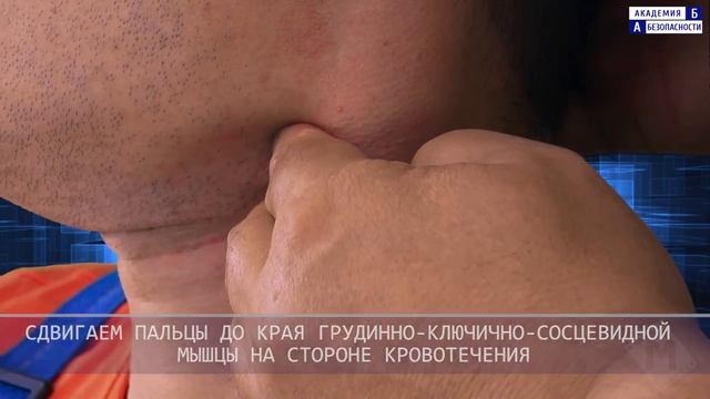 Остановка наружного кровотечения. Пальцевое прижатие общей сонной артерии