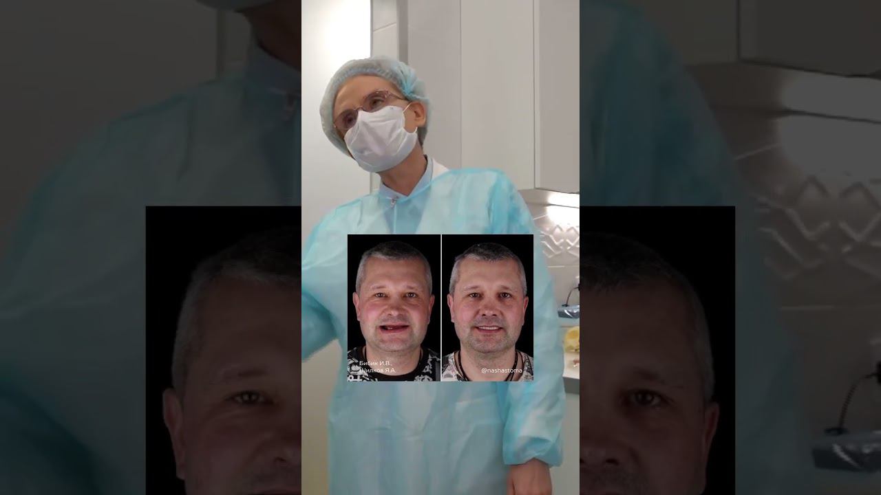 Протезирование зубов за один день на имплантах – челюсть за 1 день в СПб. Звоните: 78124169481