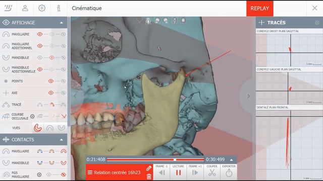 Modjaw. Дополнительные модели