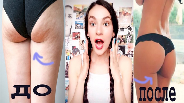 КАК ИЗБАВИТЬСЯ ОТ ЦЕЛЛЮЛИТА РАЗ И НАВСЕГДА!__ 100% РЕЗУЛЬТАТ__ ДЕШЕВЫЕ ЛАЙФХАКИ