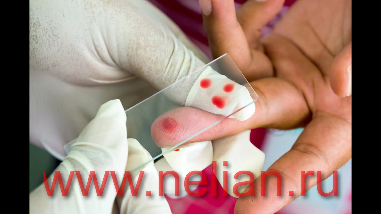 Микроскопия Нативной Крови, Подготовка стёкол для мазка (Гемосканирование капли живой крови)