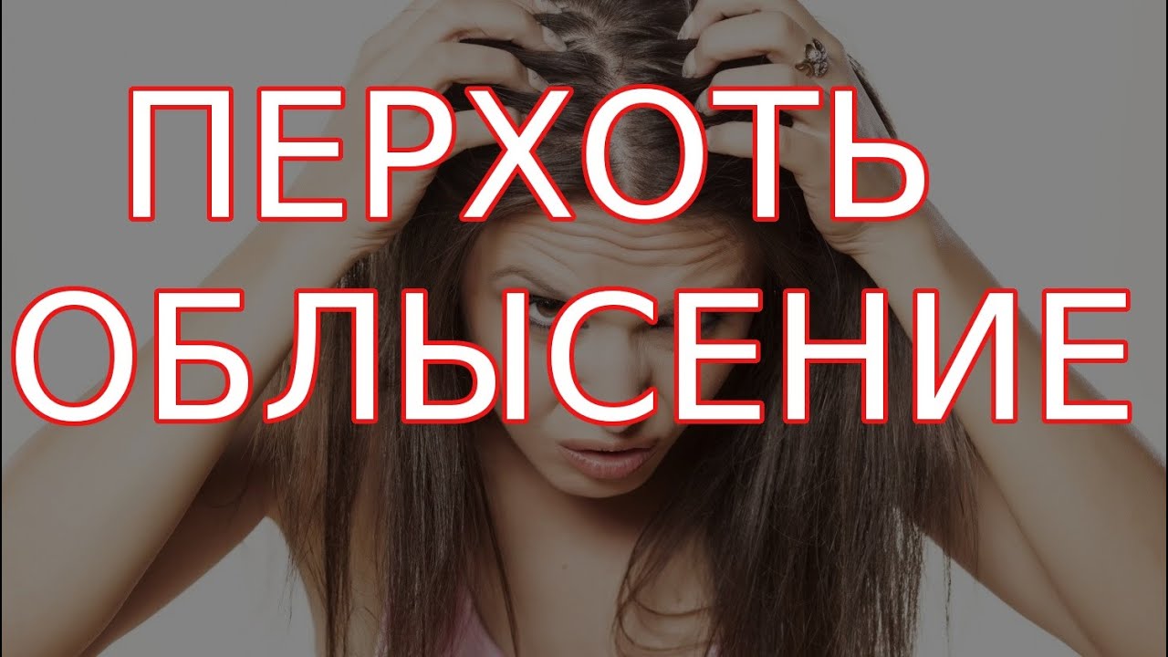 ? Перхоть (причины облысения, симптомы и лечение)