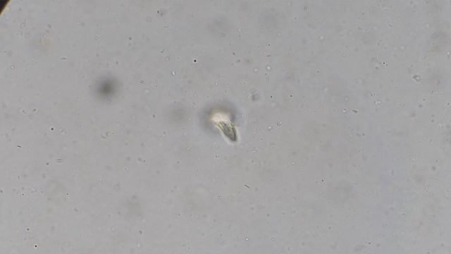 Инфузория Трубач (0063)