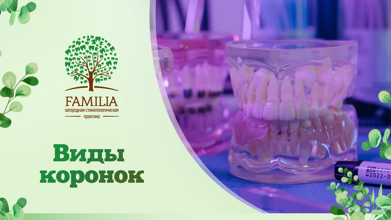 ? Виды коронок
