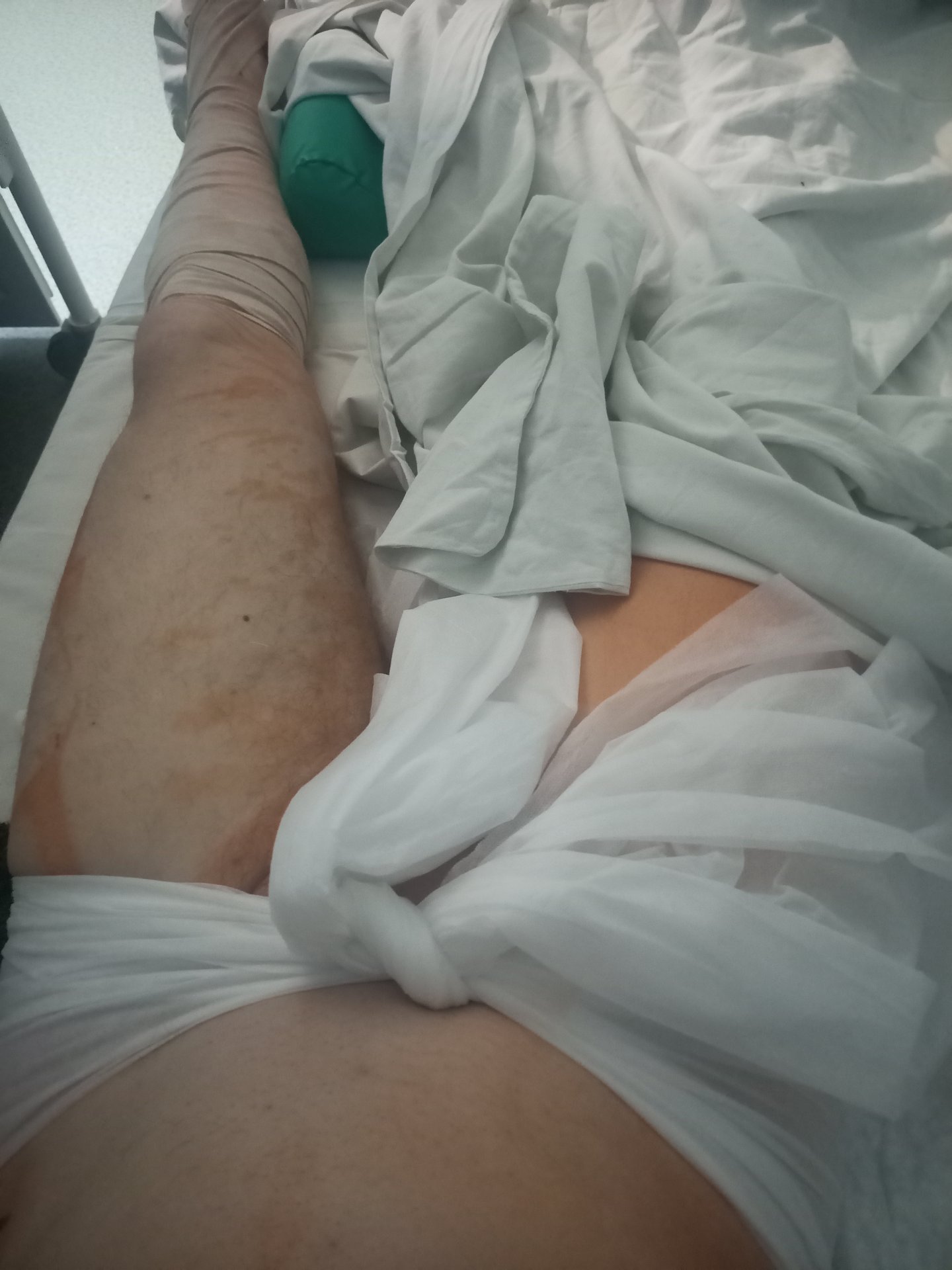 Операция ТБС. Слабонервным удалиться.