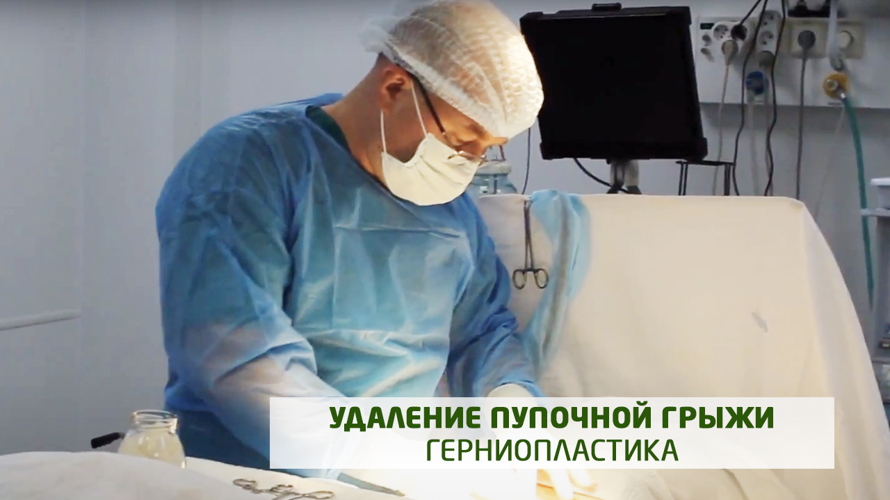 Удаление пупочной грыжи. Герниопластика