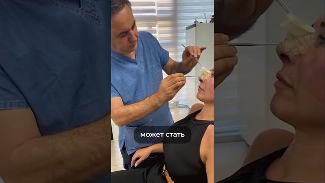 Что такое Ринопластика? ✨ | Лечение в Турции