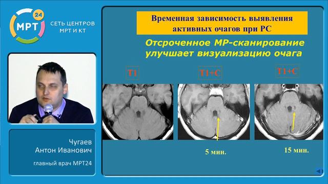 МР-диагностика демиелинизирующих заболеваний головного мозга