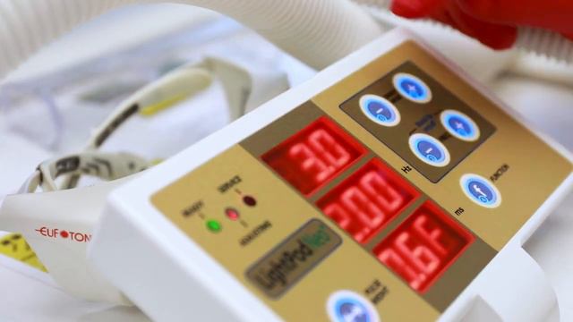 Процедура удаления сосудистых звездочек.