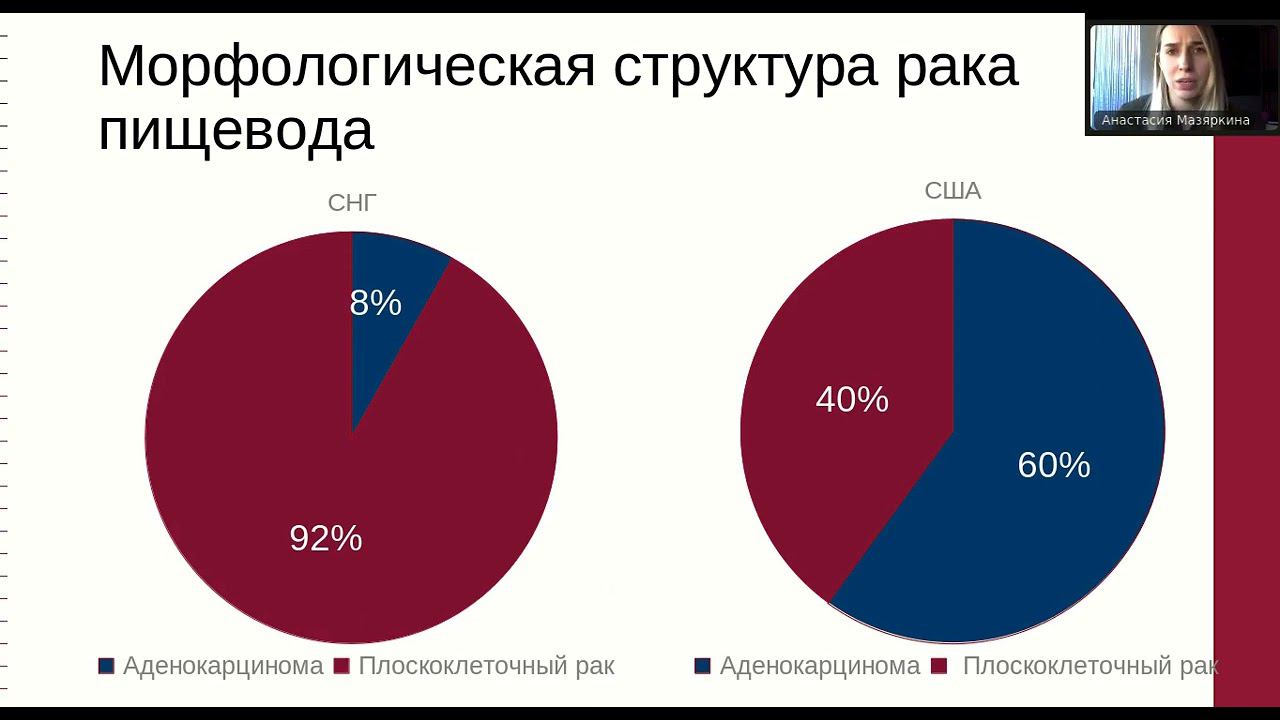 Клинический случай "Плоскоклеточный рак пищевода в исходе химического ожога" Автор: Мазяркина А.А.