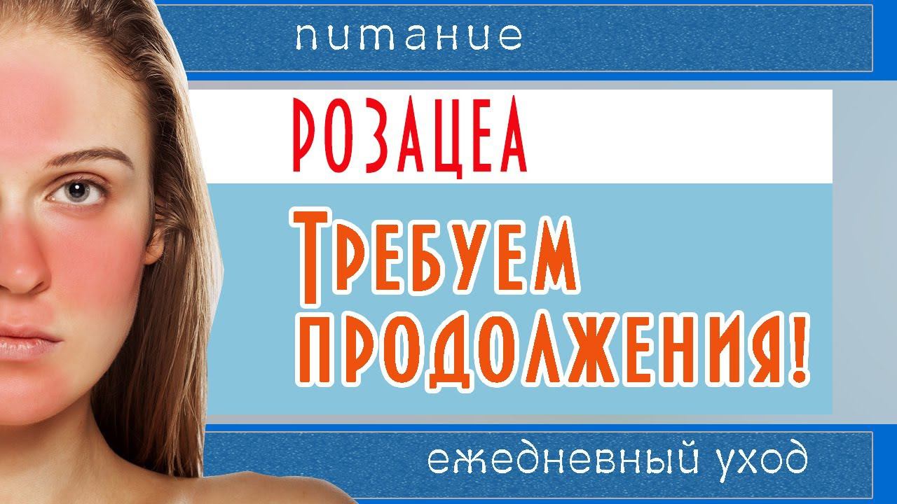 Ещё про РОЗАЦЕА | Питание при акне, розацеа, мигрени | Ответ тем, кто требует