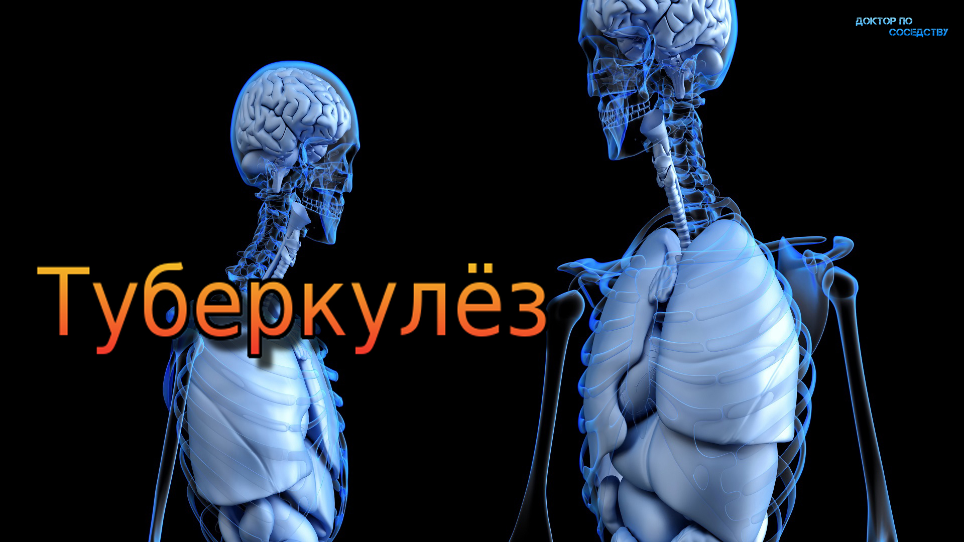 Туберкулез. Доктор по соседству.