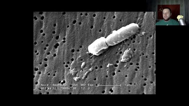 Введение в микробиологию. Часть 6. Систематика. Псевдомонады. Энтеробактерии