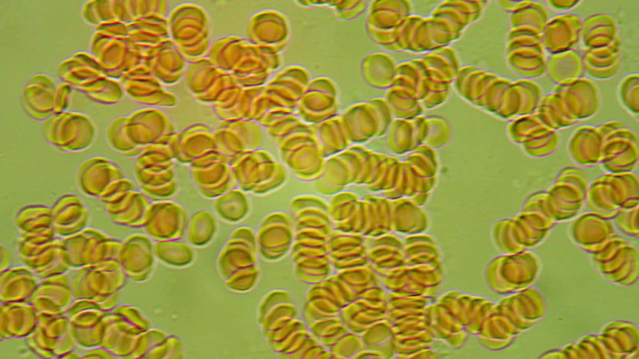 Основы гемосканирования - микроскопии нативной крови с комментариями врача, Вводное занятие, часть 2