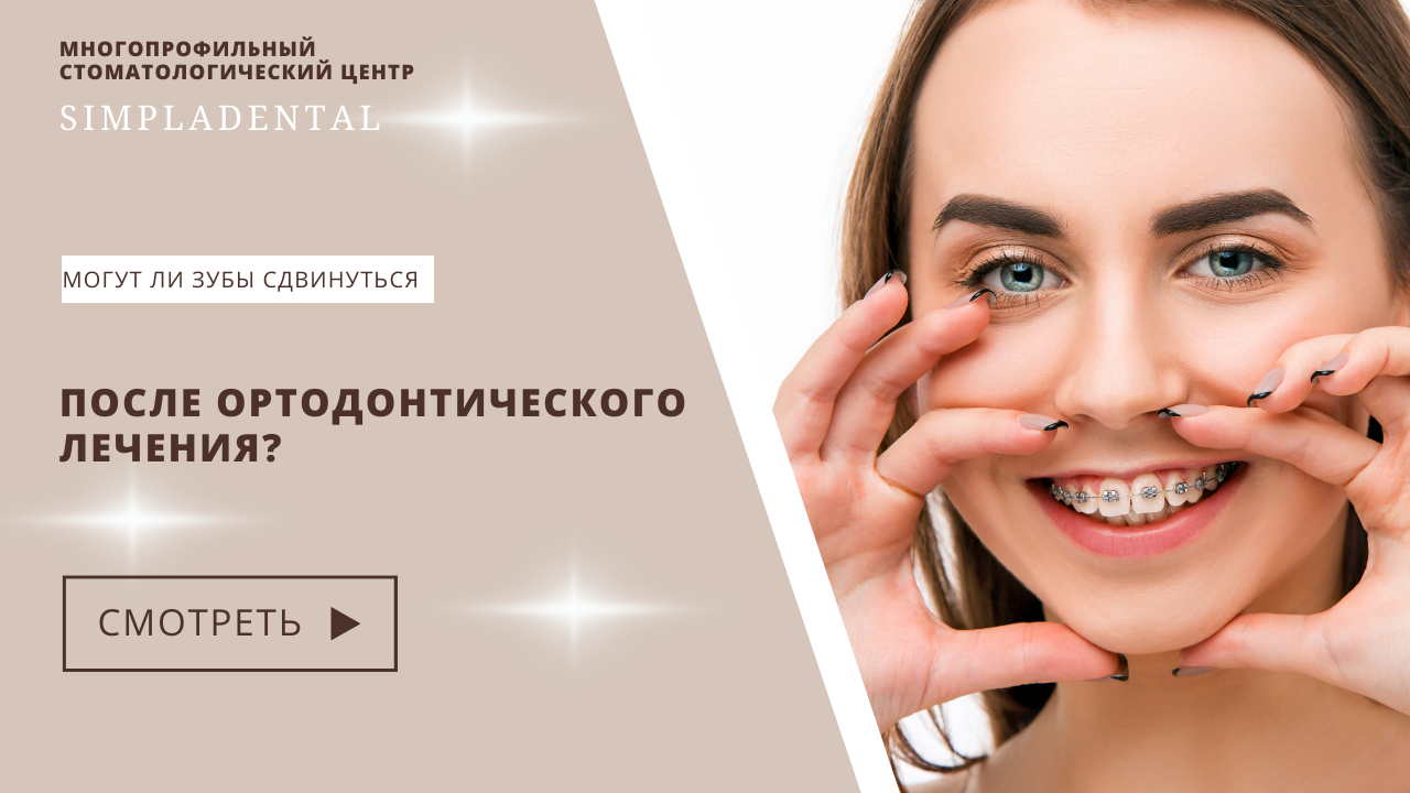 Могут ли зубы сдвинуться после ортодонтического лечения?