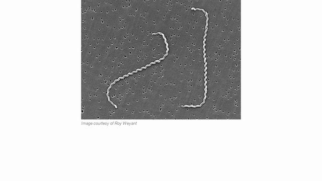 USMLE RX - 7.Микробиология - 3.Клиническая бактериология - 48.Leptospira Interrogans (Лептоспироз)